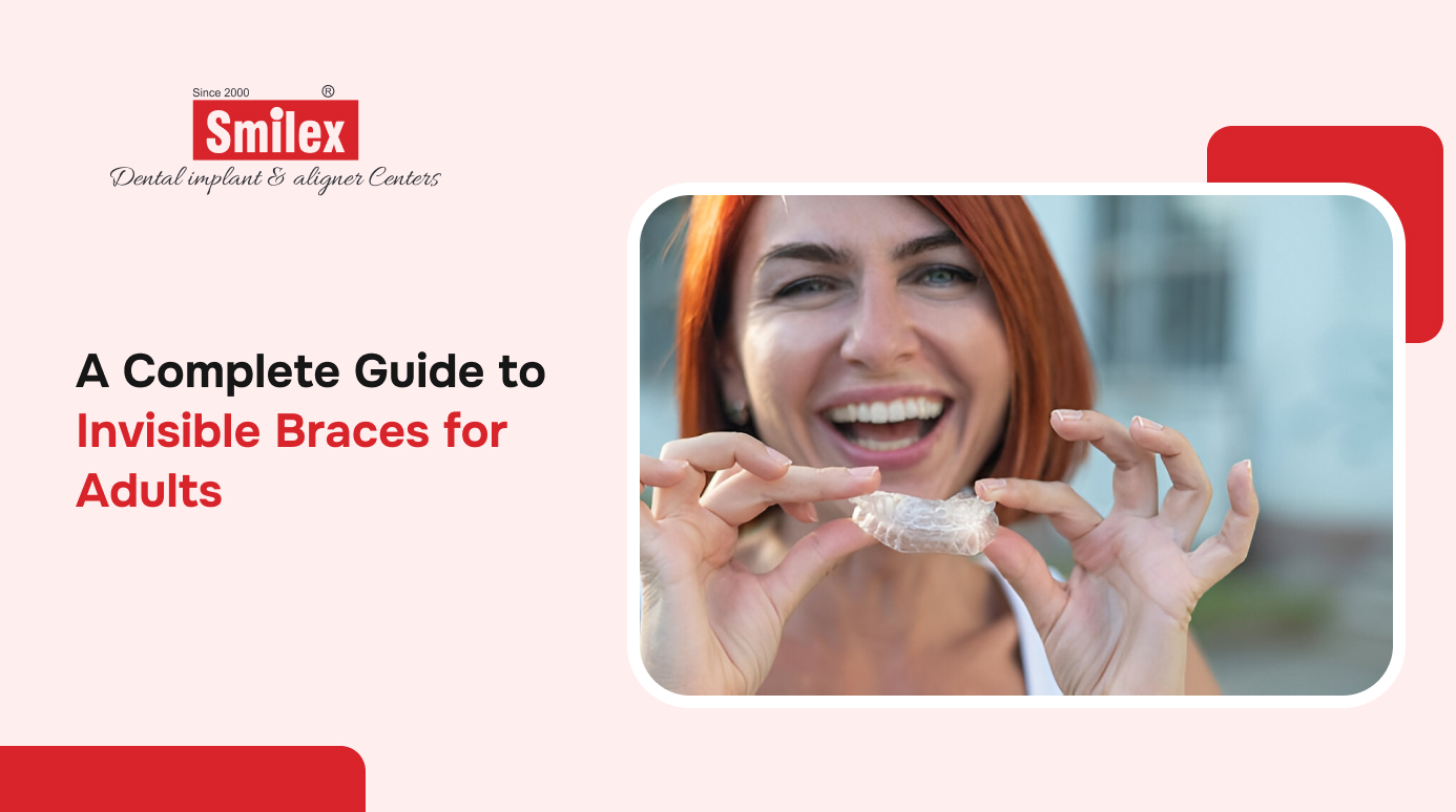 A Complete Guide to Invisible Braces for Adults - Smilex